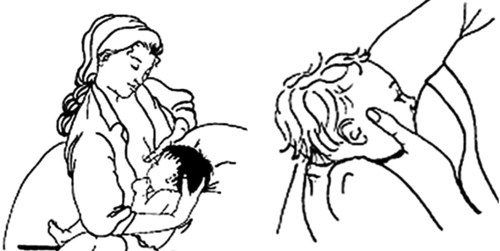 Kojení dětí s rozštěpem rtu a patra | Umění Kojení / Dr. Milada ...